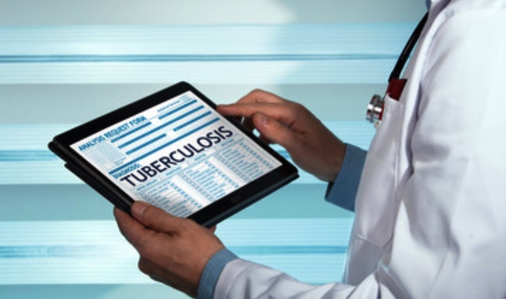 UKVI TB Test (Tuberculosis tests for UK visa applicants) - Extenseur HR